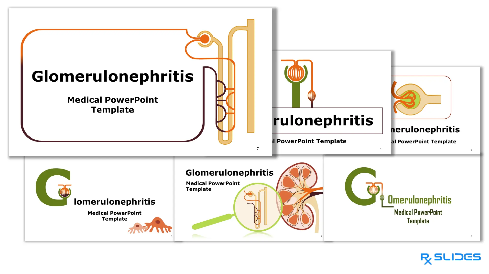 Glomerulonephritis PowerPoint Template - RxSlides - The largest online store for medical ...